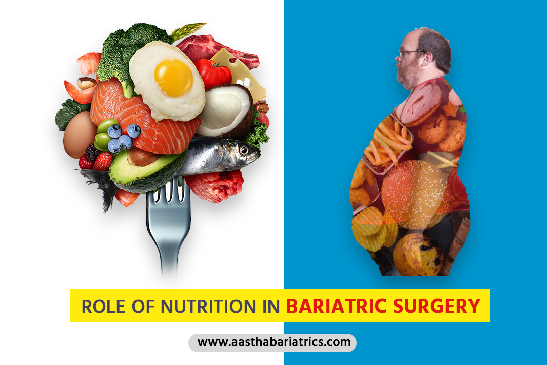 Role of Nutrition in Bariatric Surgery - Aastha Bariatrics